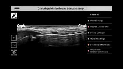 AnSo Anaesthesia Sonoanatomy by Sumo Enterprises